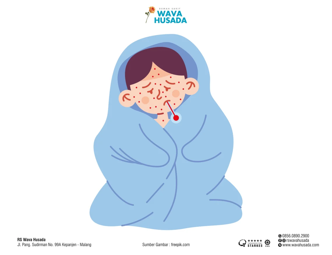 Waspada Campak: Penyakit Lama yang Masih Mengintai | Spesialis Anak ...